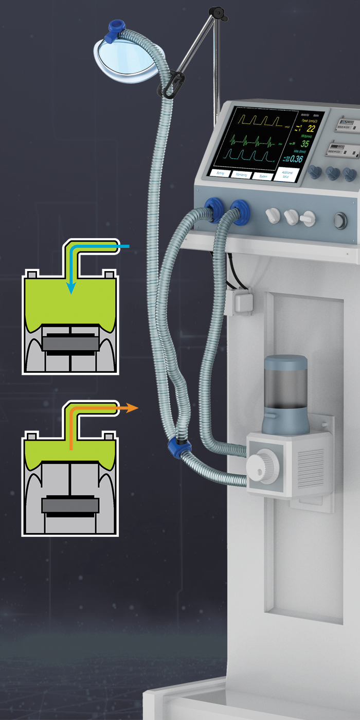 What Is Ventilator Control